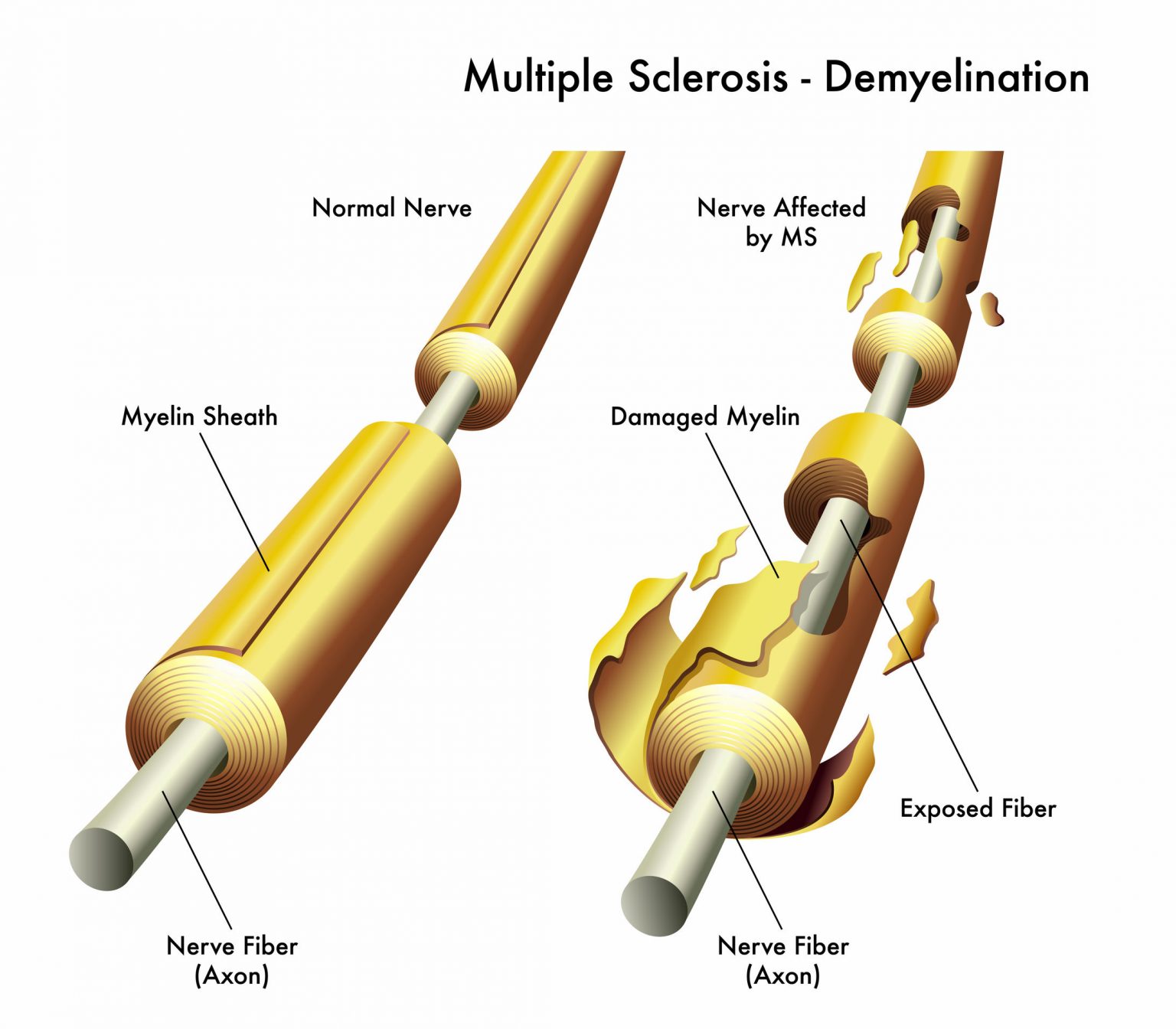 15 Benefits of Turmeric Extract – The Ultimate Guide - Active Atoms